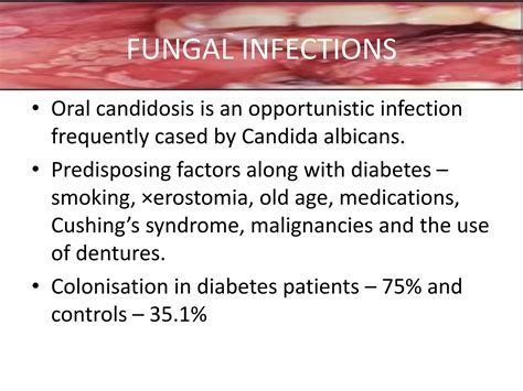 Diabetes And Oral Health Pptx