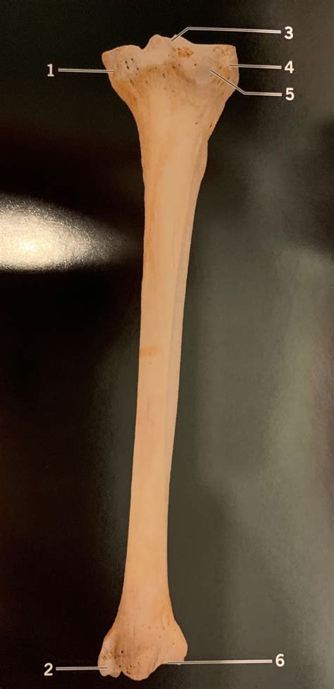 Right Tibia Posterior View Diagram Quizlet