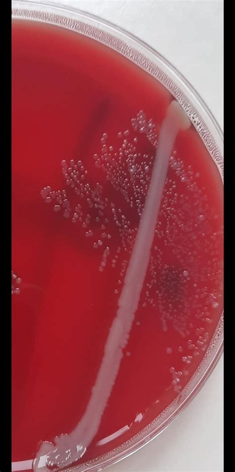 Moraxella Catarrhalis Moraxella Catarrhalis Is A Gram Negative