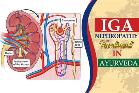 Iga肾病：肾功能衰退的评估与分析（下） 知乎