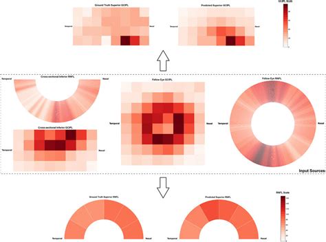 An Example Of Predicting Superior Rnfl And Gcipl In A Patient With Download Scientific Diagram