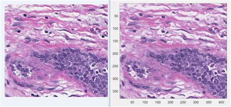 Hande Histology Color Normalization Instructions Colorassign Manual M Drexel University College