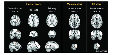 Resting State Networks Shown In White With Within Network Download Scientific Diagram