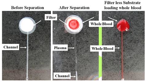 Microfluidics S Bio