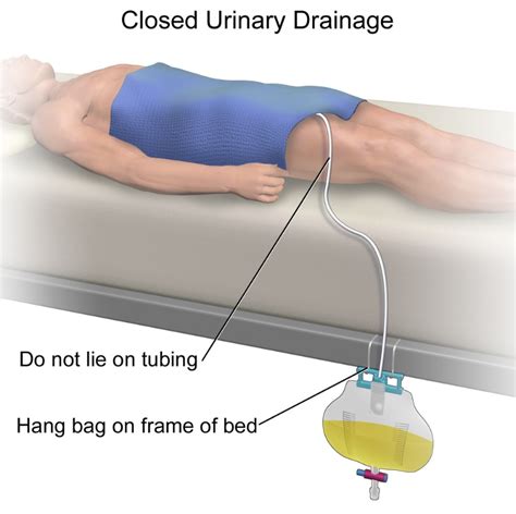 Proper Positioning Of Closed Urinary Drainage Systems For Bedridden Patients Anatomy Note