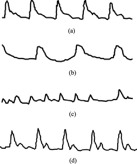 Figure 2 From A Flexible Capacitive Tactile Sensor Array With Cmos Readout Circuits For Pulse