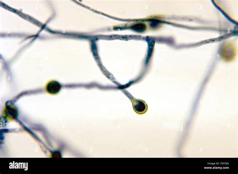 Photomicrograph Of The Conidiophores With Conidia Of The Fungus Pseudallescheria Babedii