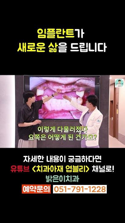 잇몸이 안보이는 이유 임플란트 임플란트치료과정 밝은이치과 리뷰 Shorts Youtube