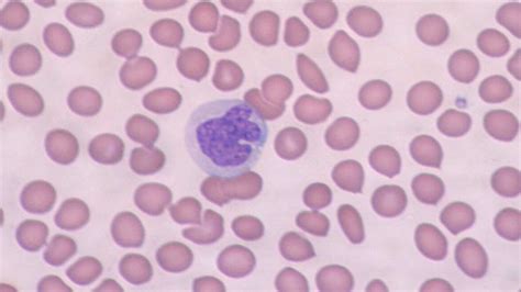 Monocytes Definition Function Causes Of High And Low Count