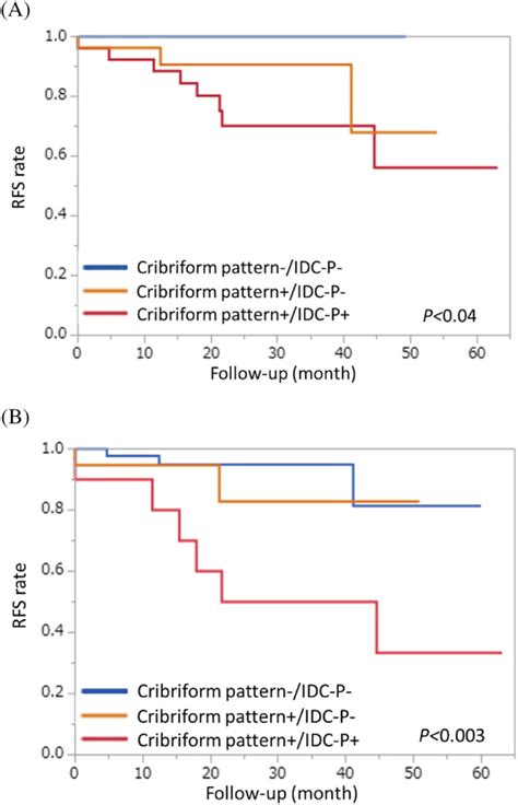 Cribriform Pattern In Prostate Tissues Predictor For Intraductal