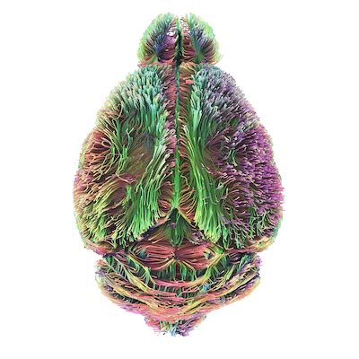 Mouse Brain 60 Direction DTI EPI Ex Vivo Biomedical Research Imaging Center