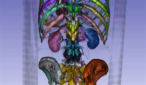 Volume Rendering Colorized With Segmentation Development 3d Slicer Community