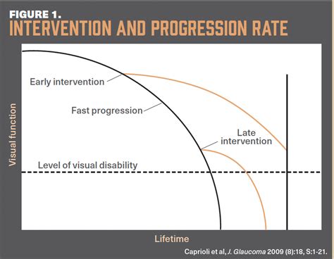 Monitoring Glaucoma Progression Rate To Preserve Patients Vision