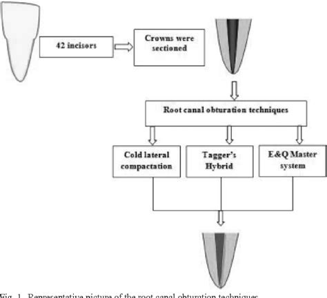 Figure 1 From Assessment Of The Apical Seal Of Root Canals Using