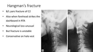Fractures And Dislocation Spinepptx