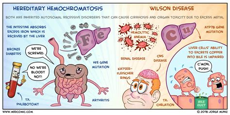 Hemochromatosis Eye
