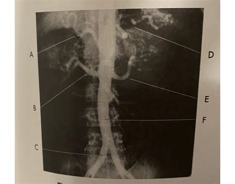 Ir Abdominal Aortogram Fig 2 Quiz