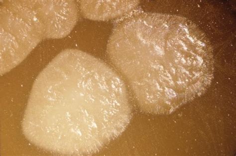 Clostridium Botulinum Type E Colonies B Thomas Photo Research