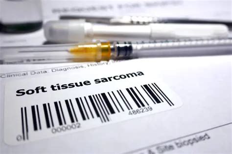 Soft Tissue Sarcoma Hk Dengyuemedicine