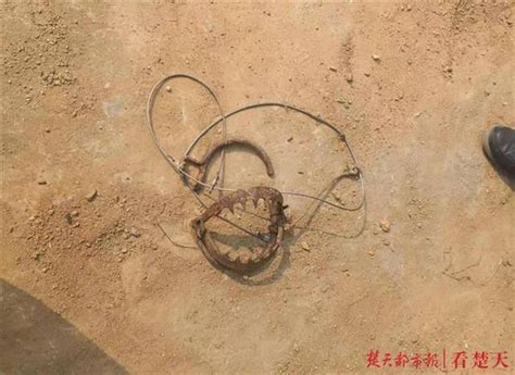 武汉男子山间误踩捕兽夹 民警辅警接力抬下山紧急救治 凤凰湖北