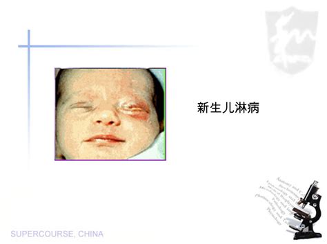 梅毒螺旋体图片症状 梅毒螺旋体图片手绘图 伤感说说吧