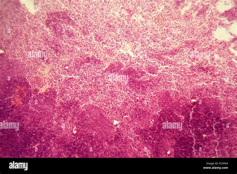Lymph Node Microscope Slide