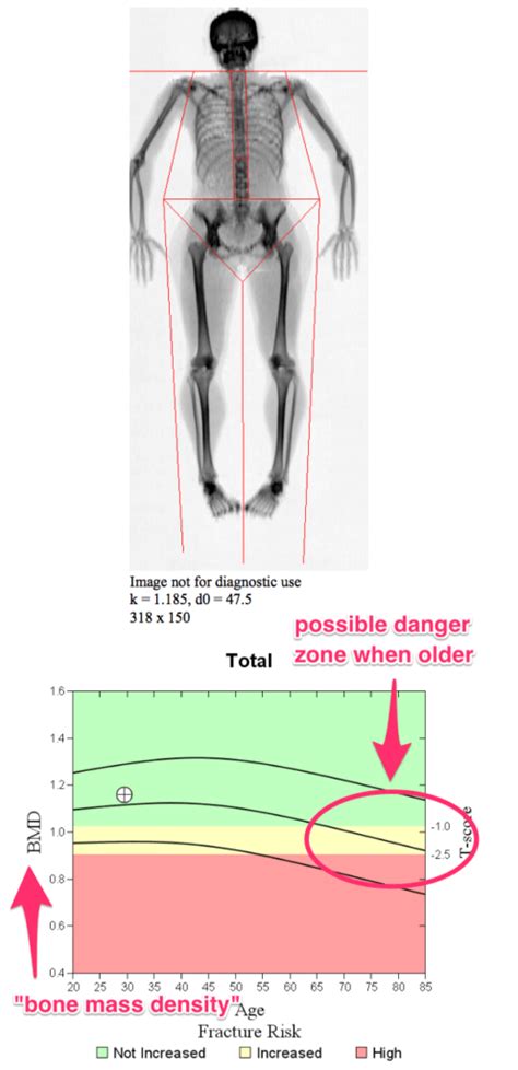 How A Dexa Body Fat Muscle And Bone Scan Can Help You Get Fit