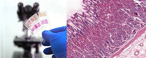 Etiology Classification With Ai For High Accuracy Dacdigital