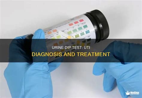Urine Dip Test Uti Diagnosis And Treatment Medshun