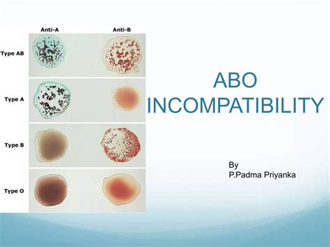 Abo Incompatibility Pptx