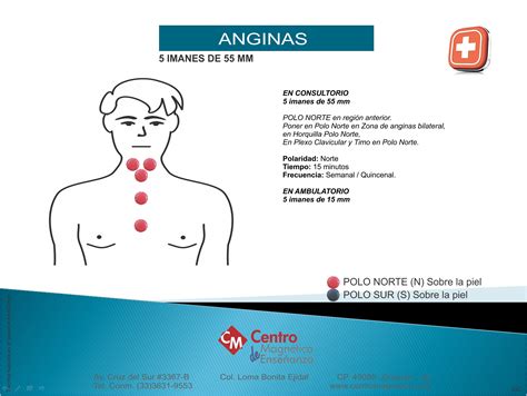 Centro Magnético Tratamiento De La Amigdalitis Con Biomagnetismo