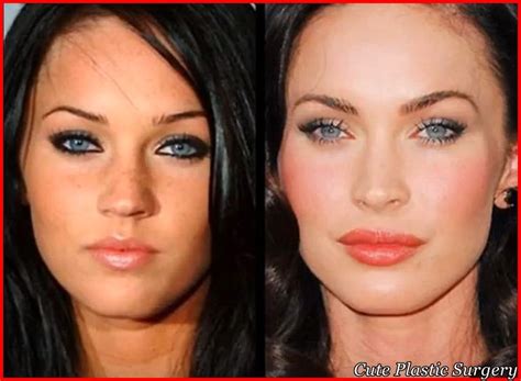 Megan Fox Plastic Surgery Pictures Revealed Celebrities Plastic Surgery