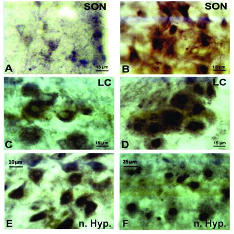 Prp 1 Ir Neural Structures In The A B Supraoptic Nucleus Son C