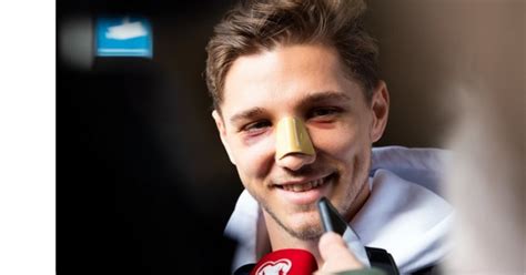 슈타르크 코 골절상에도 독일 대표팀 합류 강행하다