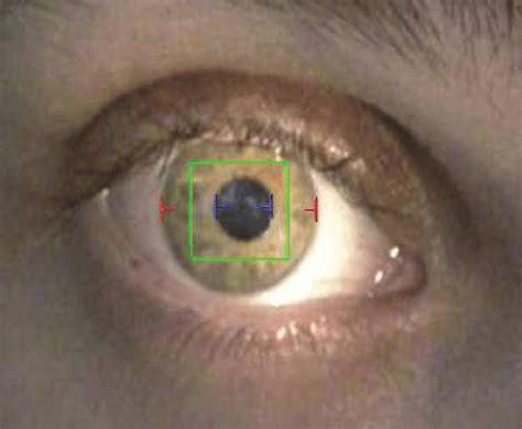 Estimating Pupil Diameter From A Rectangular Region Containing Only The