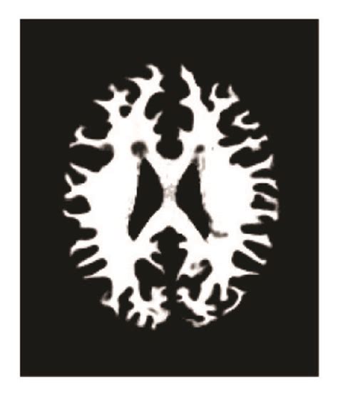 segmentation comparisons when simulated mri images have degraded by