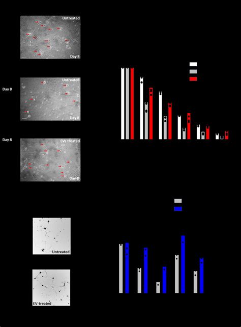 Astrocyte Toxicity To Motor Neurons Is Reduced When Astrocytes Are Download Scientific Diagram