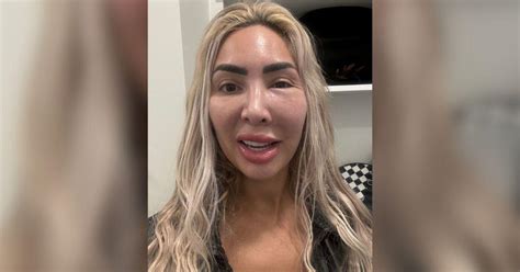 Teen Mom Farrah Abraham Reveals Swollen Face After Botched Plastic