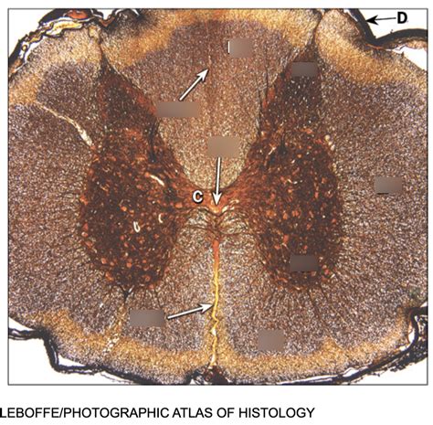 Lab A Cross Section Of Spinal Cord Diagram Quizlet