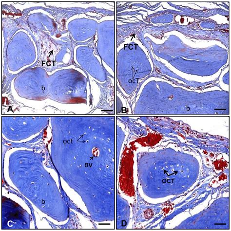 Histological Sections Of The Rat Calvaria Critical Size Defect Treated Download Scientific