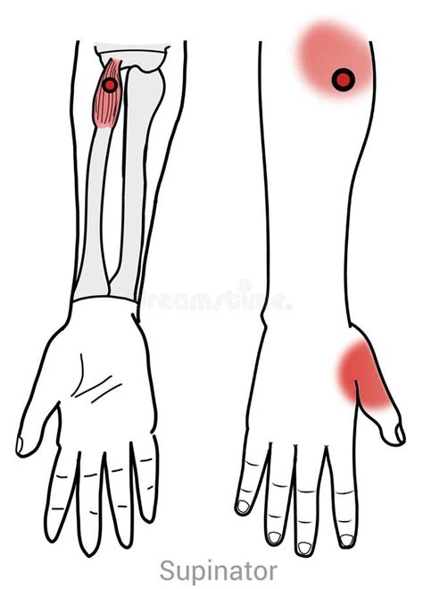 Supinator Stock Illustration Illustration Of Myofascial 304713576