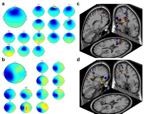 The Scalp Maps And Equivalent Dipole Source Locations After Ic Download Scientific Diagram