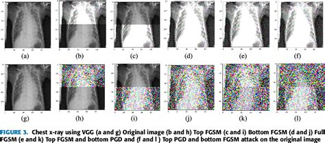 Figure 3 From The Impact Of Simultaneous Adversarial Attacks On Robustness Of Medical Image