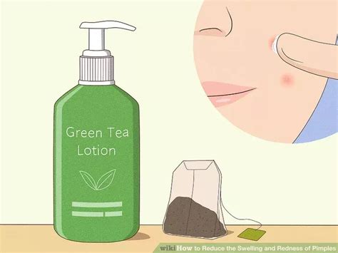 Ways To Reduce The Swelling And Redness Of Pimples Artofit