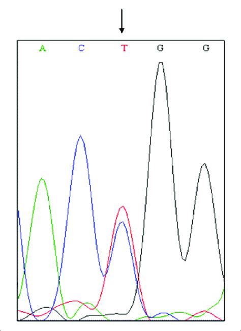 Sequencing Of The Fragment Containing Exon And Part Of The Exon Of Download Scientific