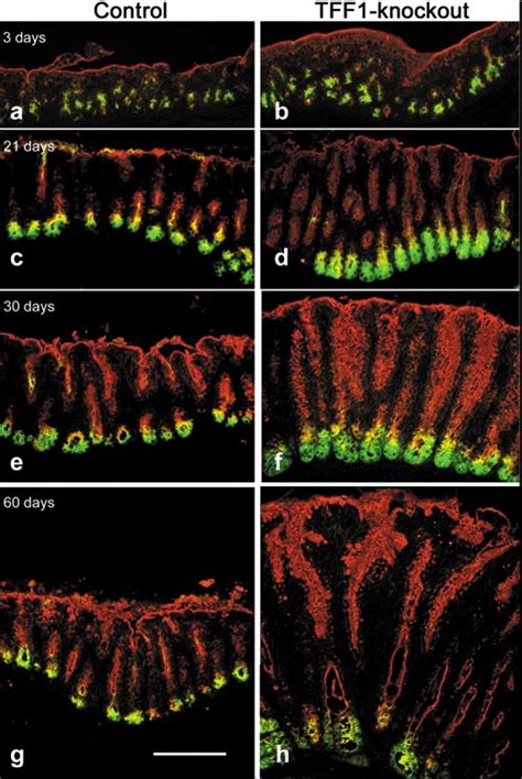 Lectin Histochemical Analysis Of The Antral Mucosa Of Normal A C E Download Scientific