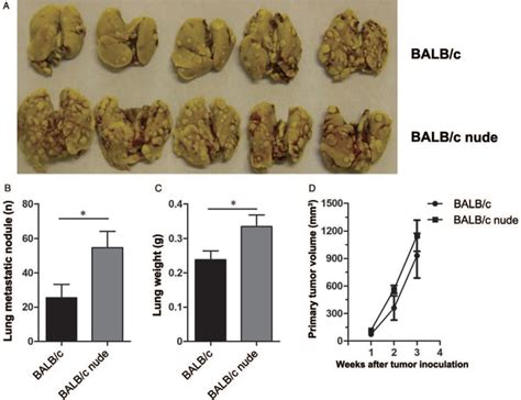 Interferon Gamma Inhibits Aldehyde Dehydrogenasebright Cancer Stem