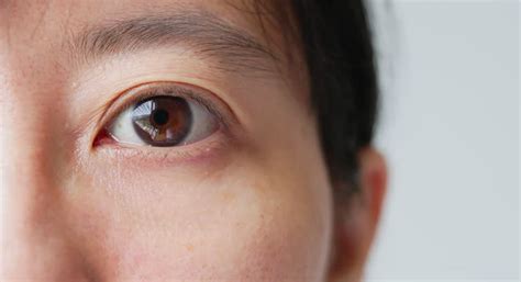 15 Woman Puffy Eyes Stock Videos Footage And 4k Video Clips Getty Images