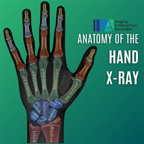 The Anatomy Of A Imaging And Intervention Associates