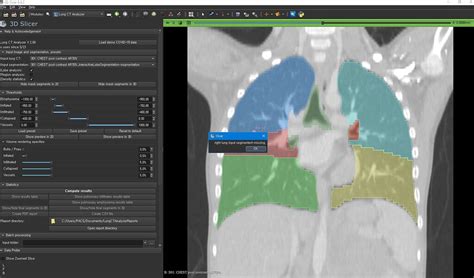 Lung CT Analyzer Error Message Support 3D Slicer Community